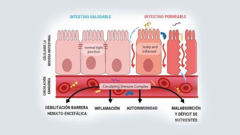 ¡Prevenga el Intestino permeable! – NaturaVital